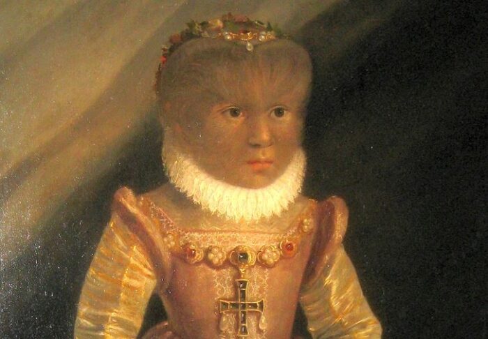 Werewolf Fact #73 – Hypertrichosis, excessive hair growth (“werewolf ...